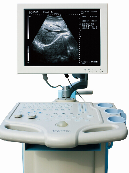 KX2800 Full digital human B mode ultrasonic diagnostic instruments