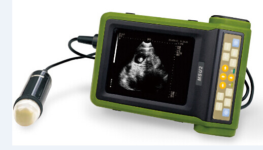 MSU2 portable mechanical sector ultrasound scanner